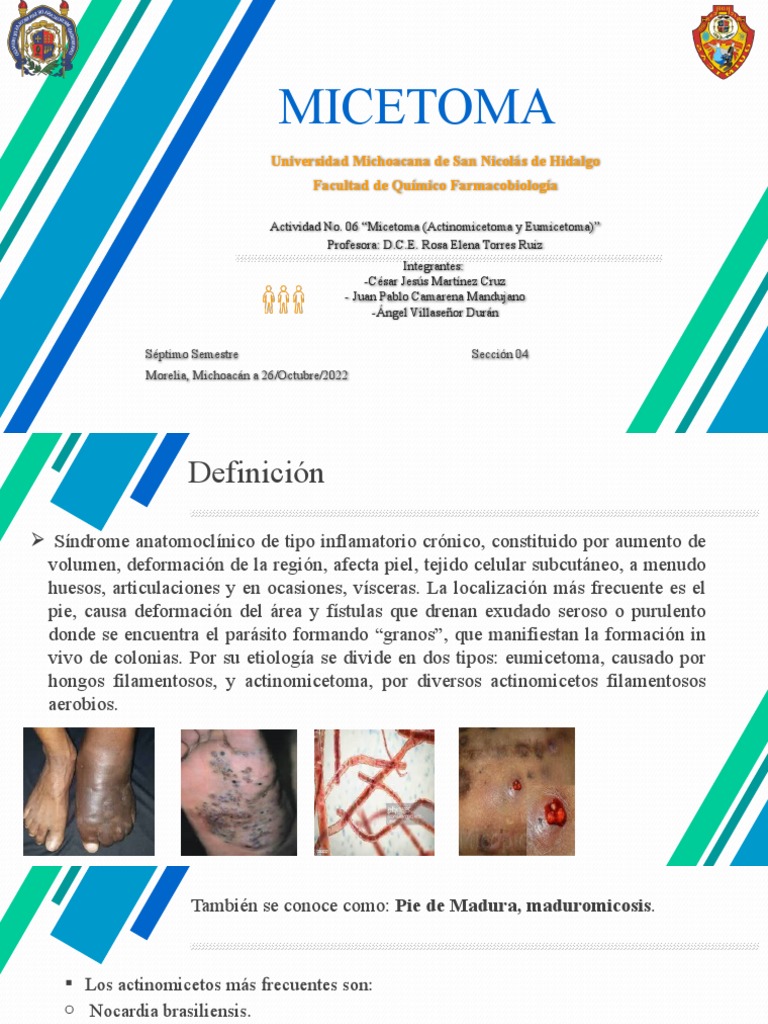 Micetomappt | PDF | Hueso | Medicina CLINICA