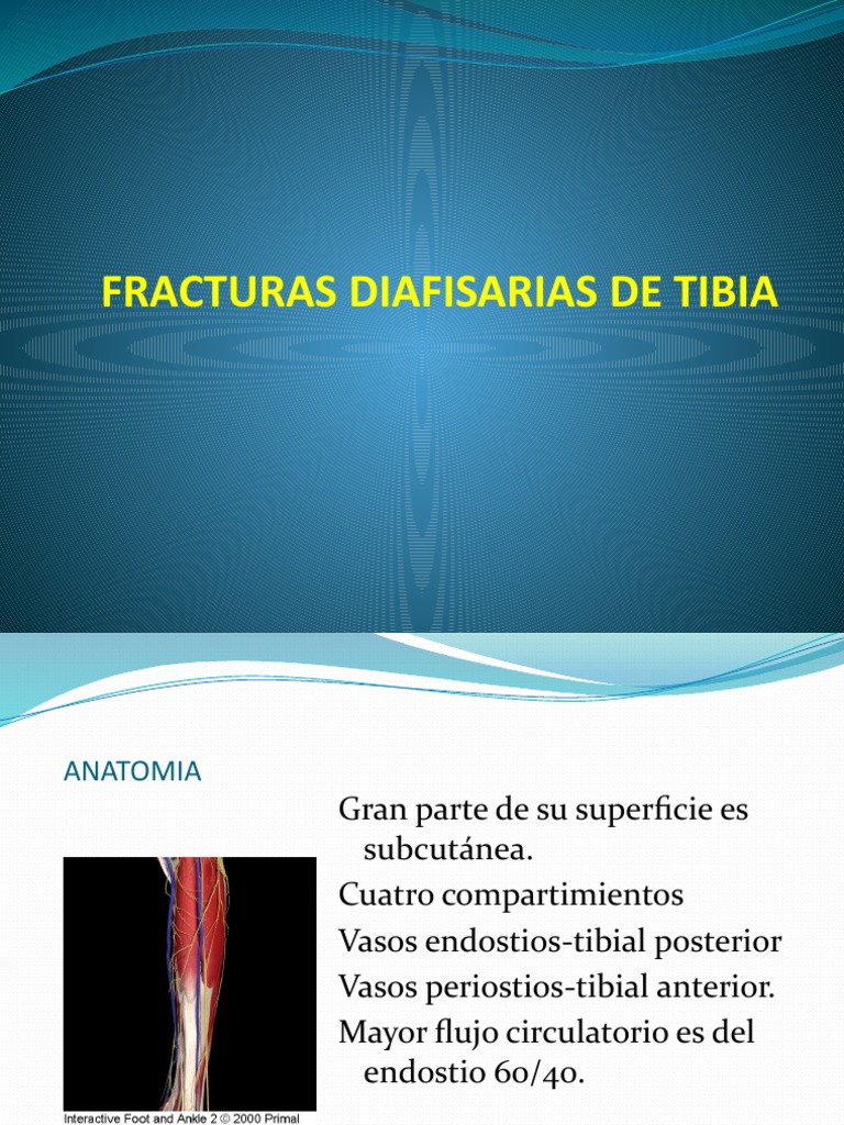 1.b Fracturas Diafisarias de Tibia | PDF