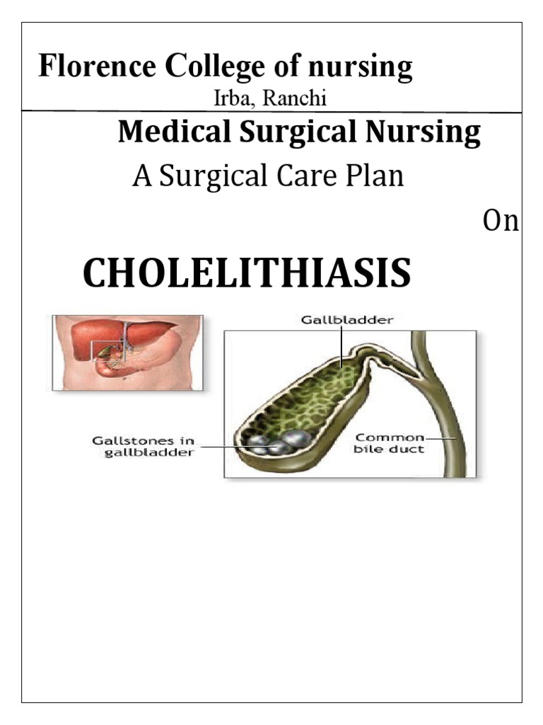 Nursing Care Plan: Cholelithiasis | PDF | Human Eye | Surgery