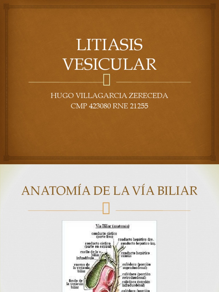 Litiasis Vesicular: Diagnóstico y Tratamiento | PDF | Medicina CLINICA ...