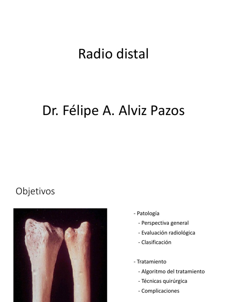Tratamiento de Fracturas del Radio Distal | PDF | Sistema ...
