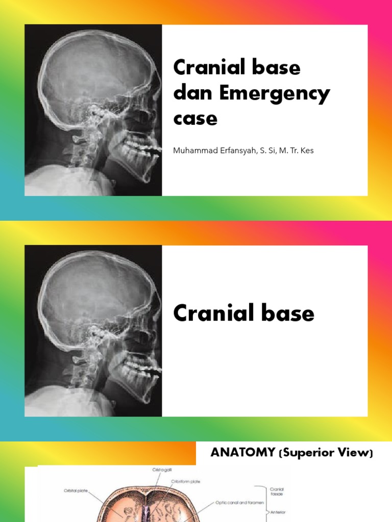 Cranial Base Dan Emergency Case | PDF | Skull | Human Head And Neck