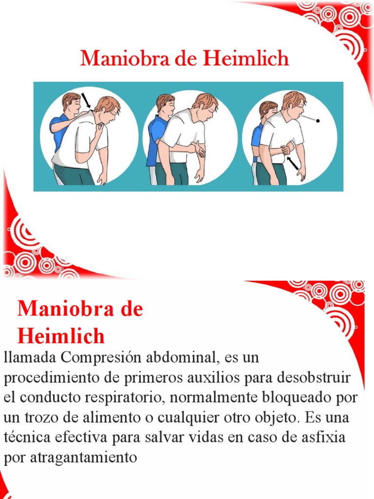 Presentación Maniobra de Heimlich | PDF