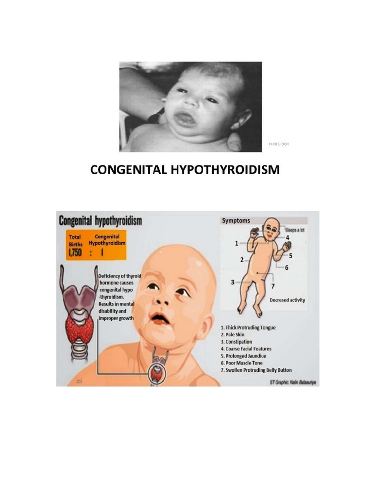 NEWBORN EXPLANATION Final | PDF | Metabolism | Thyroid