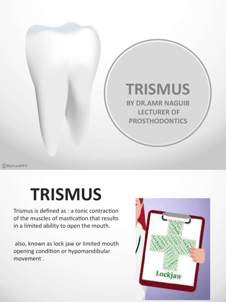 Trismus and Splint | PDF | Diseases And Disorders | Health Care