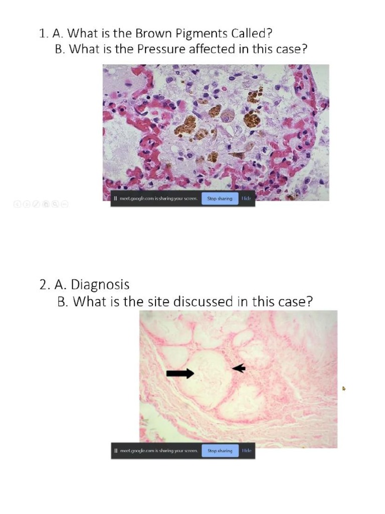 Pathology Practicals | PDF