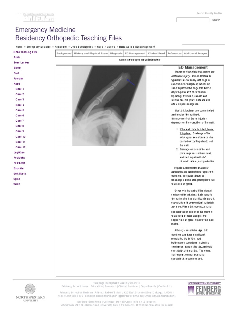 Tuft Fracture1 | PDF | Self-Improvement