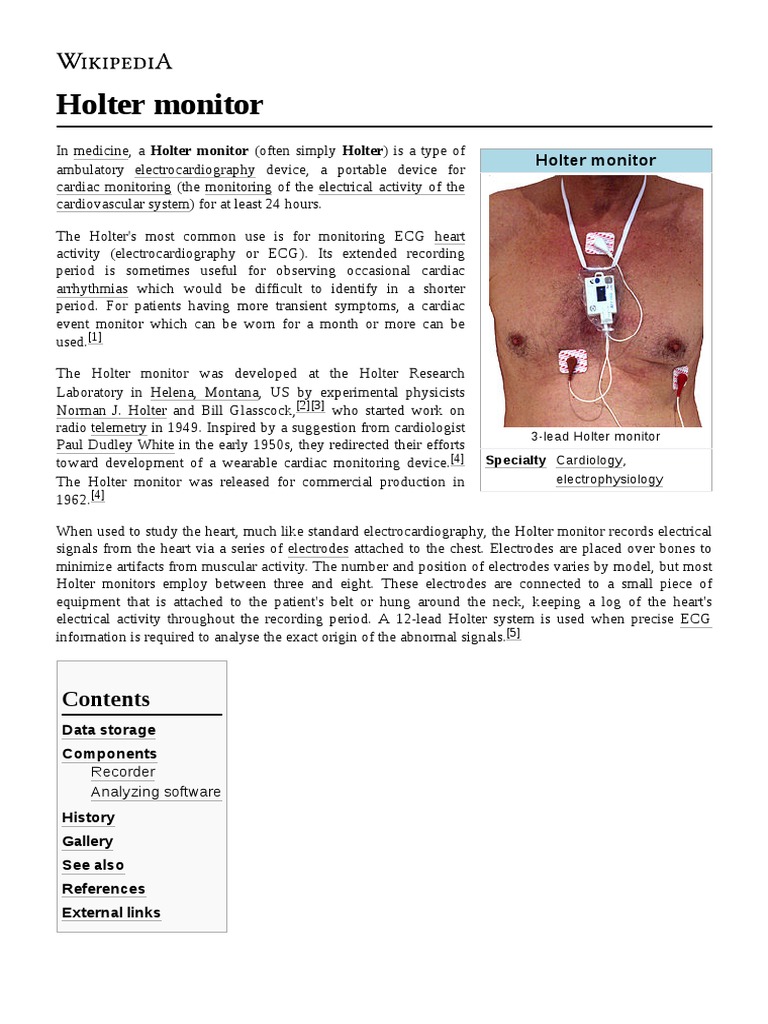 Holter Monitor | PDF