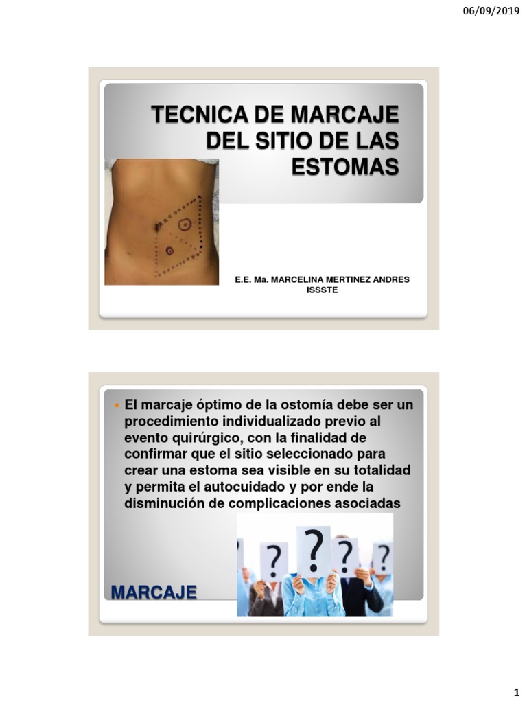 Técnicas de Marcaje para Estomas | PDF | Abdomen | Especialidades Medicas