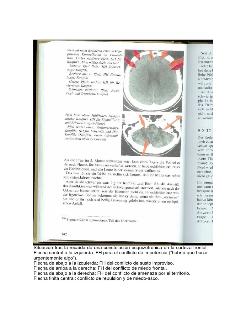 02 Pages From Nueva-medicina-germanica-Parte-I-Dr - Ryke-Geerd-Hamer | PDF | Orgasmo | Epilepsia