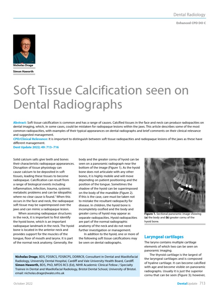 Soft Tissue Calcification Seen On Dental Radiographs | PDF | Atheroma ...