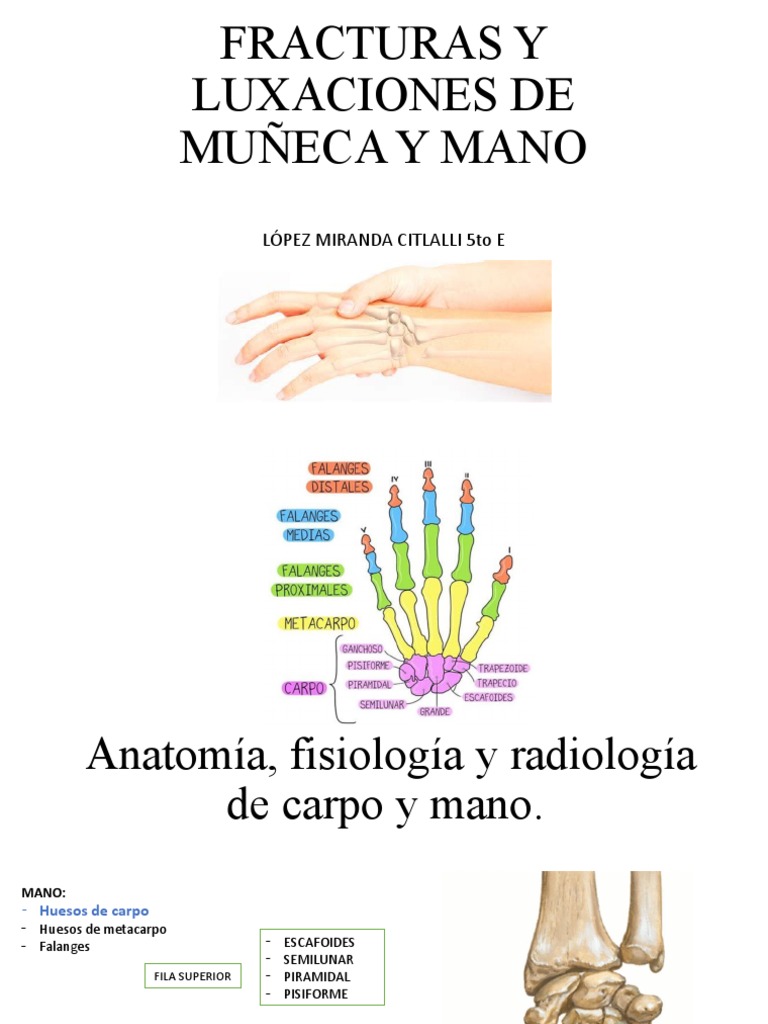 Fracturas y Luxaciones de Mano | PDF | Mano | Extremidades (anatomía)