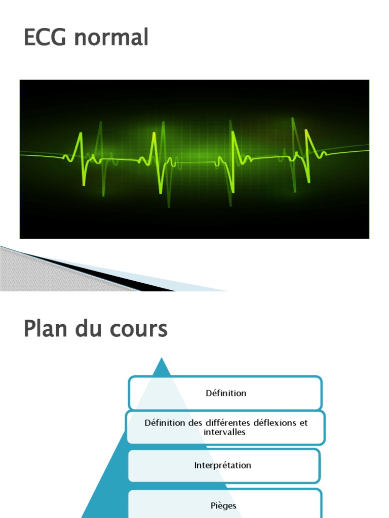 2-ECG Normal Élite | PDF | Électrocardiographie | Système circulatoire