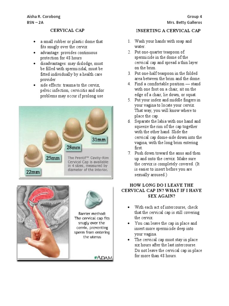 Instructions for Inserting and Removing a Cervical Cap | PDF | Vagina ...
