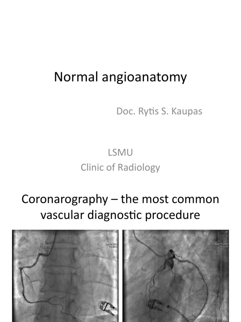 3.normal Angioanatomy | PDF | Angiography | Radiology