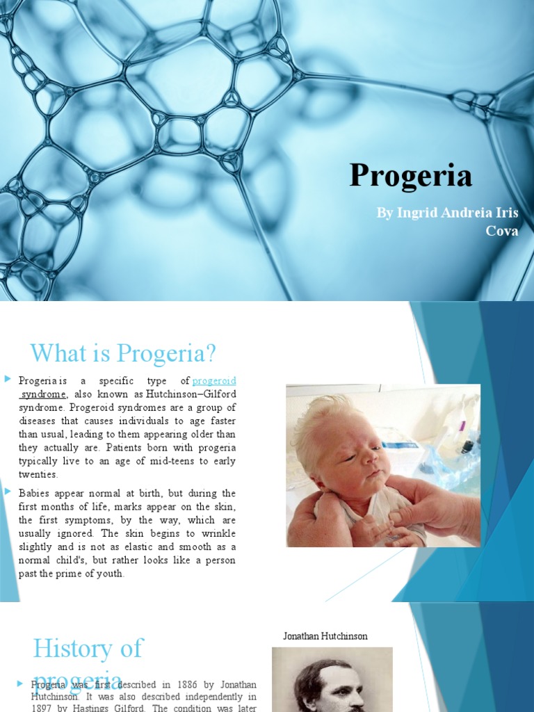 Progeria | PDF | Genetics | Epidemiology