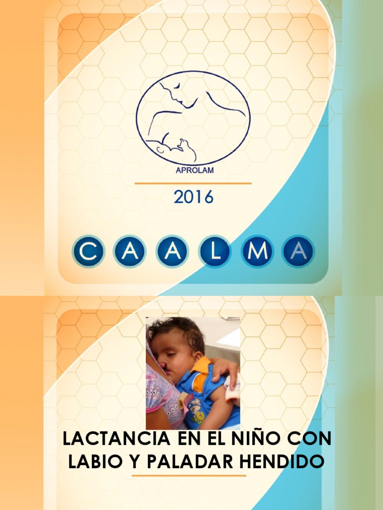 Lactancia en el niño con labio y paladar hendido | PDF