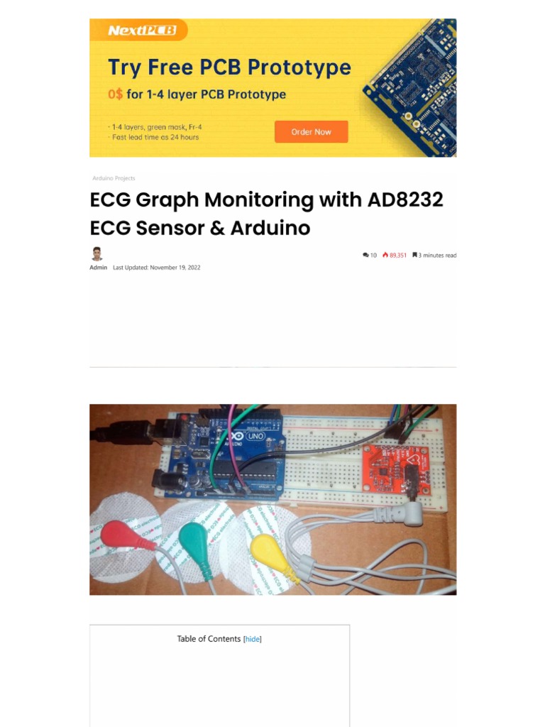 ECG Graph Monitoring With AD8232 ARDUINO | PDF
