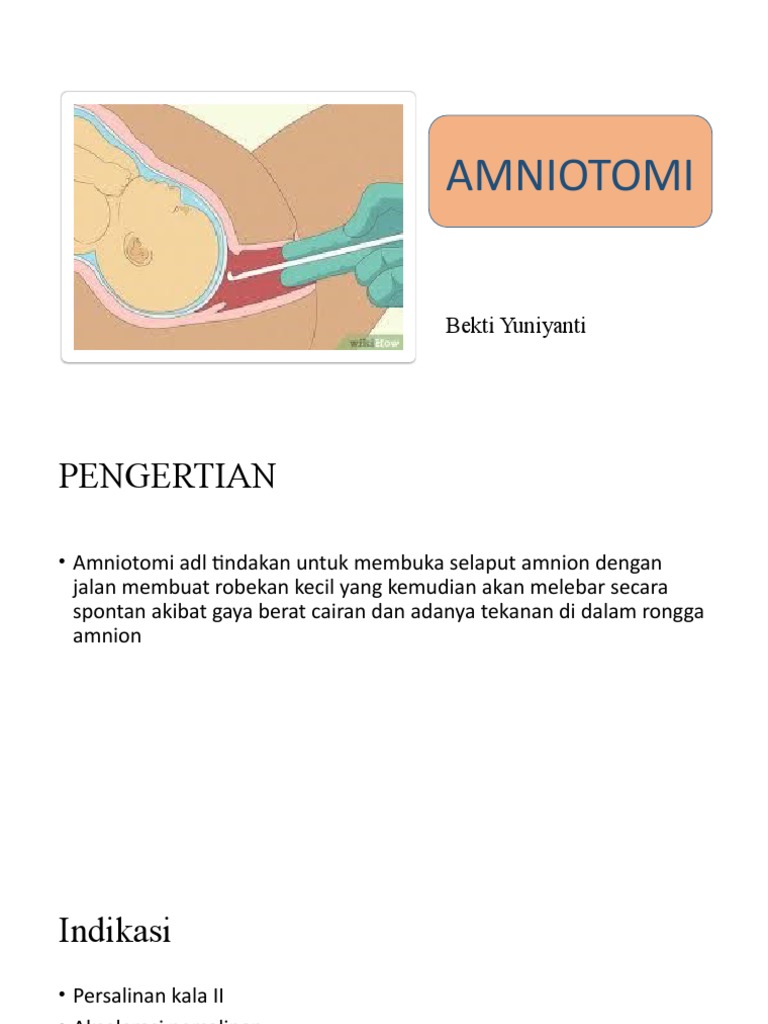 AMNIOTOMI | PDF