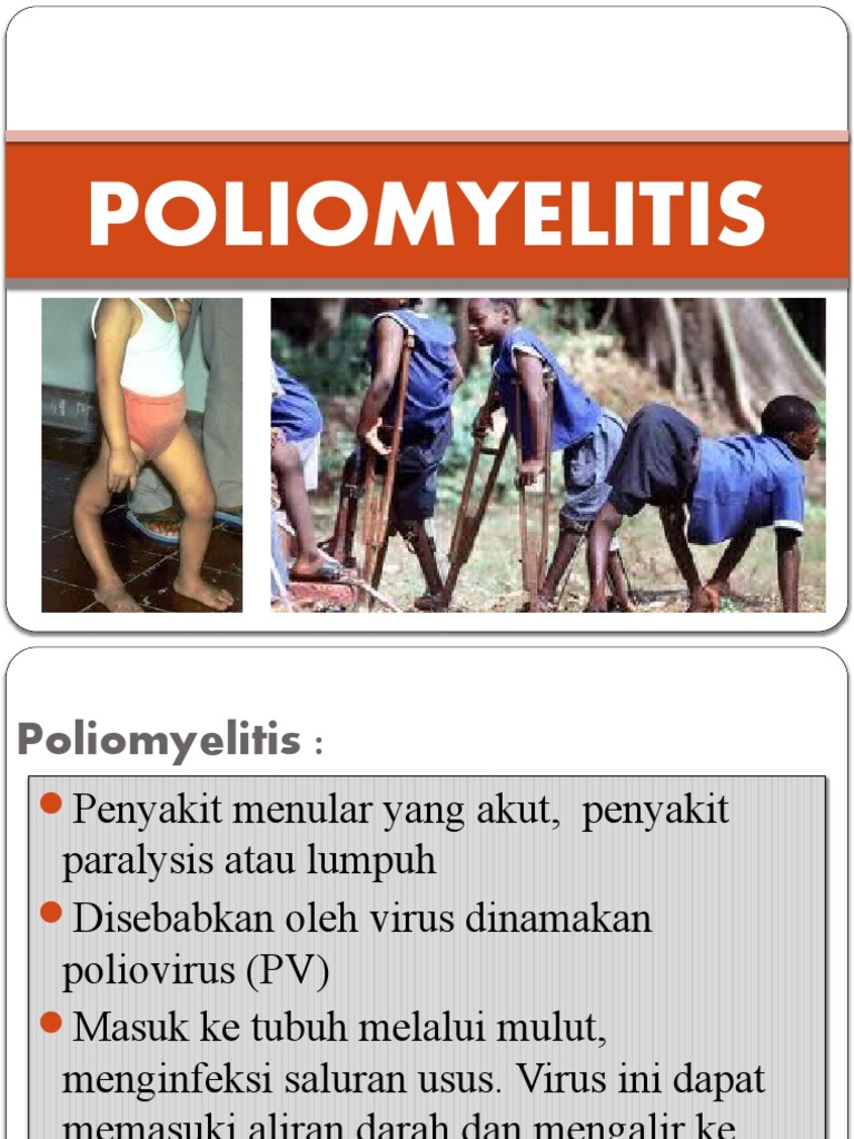 POLIOMYELITIS | PDF