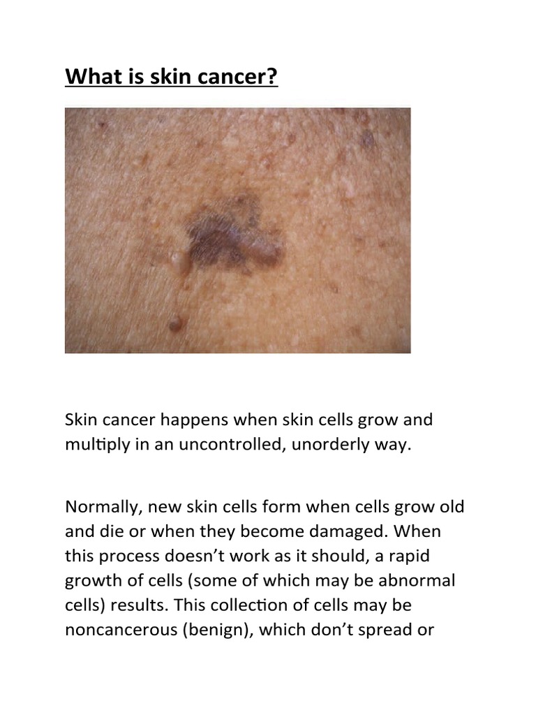 What is Skin Cancer? Types, Causes, Symptoms & Risk Factors | PDF ...