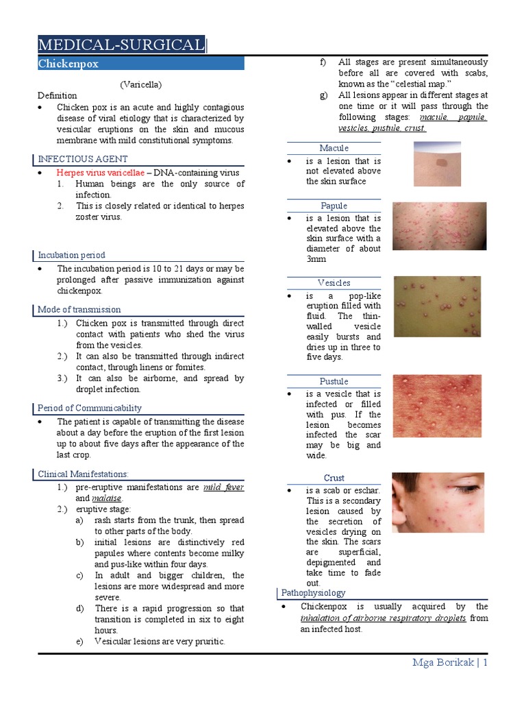 Chickenpox | PDF | Hiv/Aids | Diagnosis Of Hiv/Aids