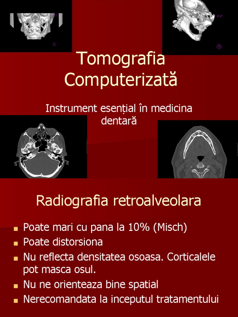 2.1. Tomografia Computerizata | PDF