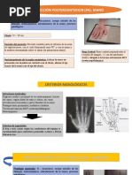 Proyecciones Radiográficas de Mano | PDF | Mano | Extremidades (anatomía)