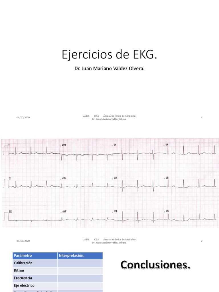 Copia de Ejercicios EKG en Angina Estable e Inestable | PDF