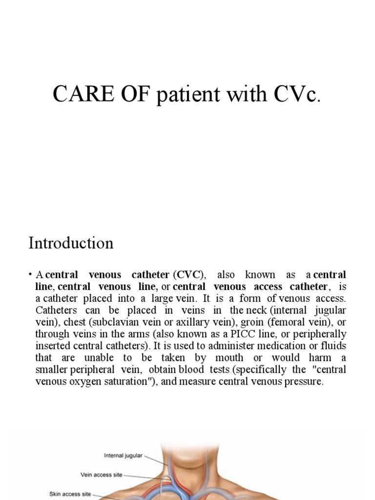 Care of CVP Line | PDF | Intravenous Therapy | Clinical Medicine