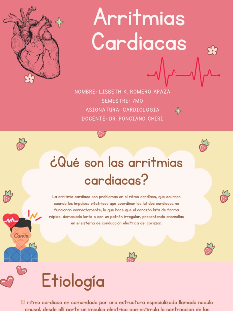 Arritmias Cardiacas | PDF | Corazón | Fisiología Cardiovascular