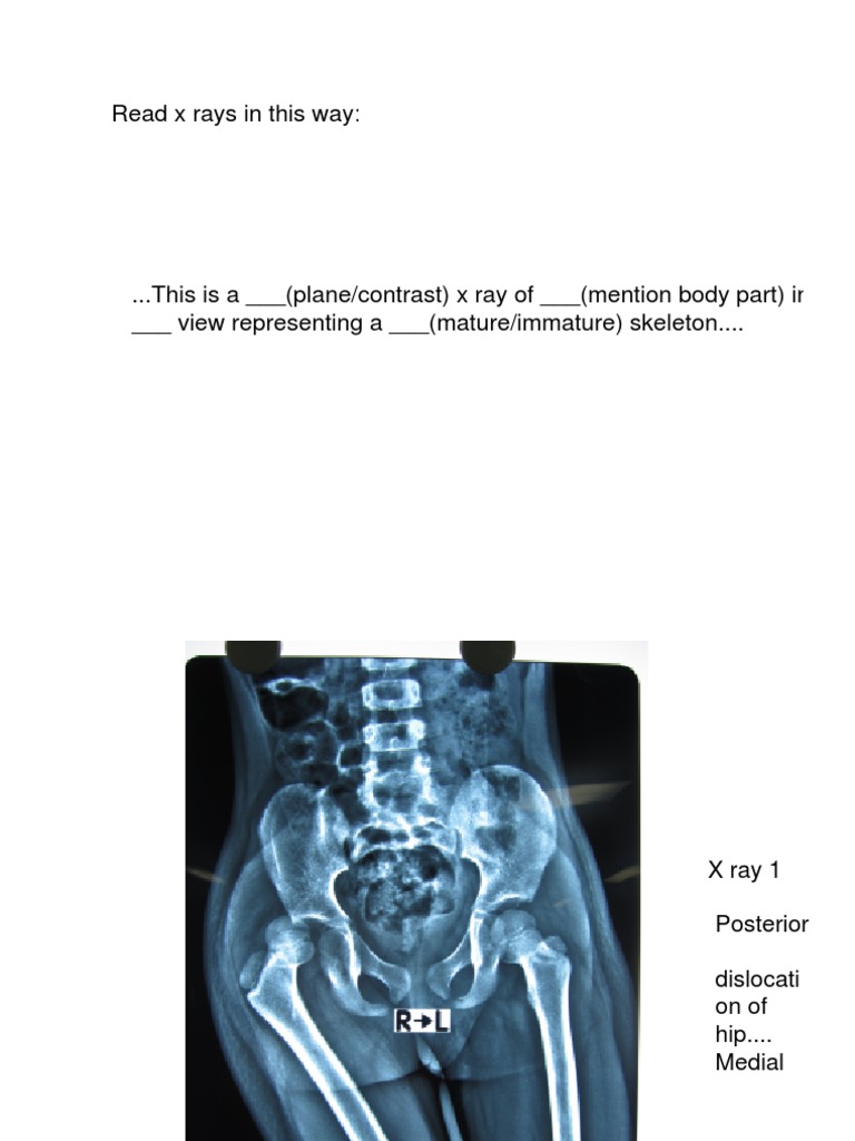 Ortho X Ray Labeled-1 | PDF