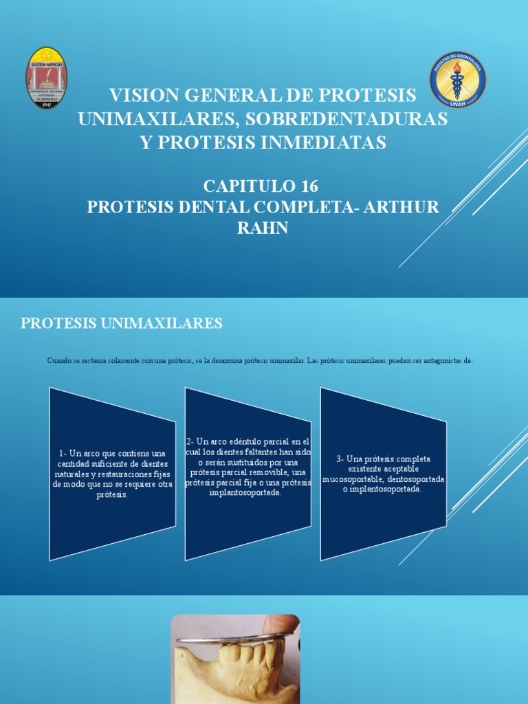 Vision General de Protesis Unimaxilares, Sobredentaduras y Protesis ...