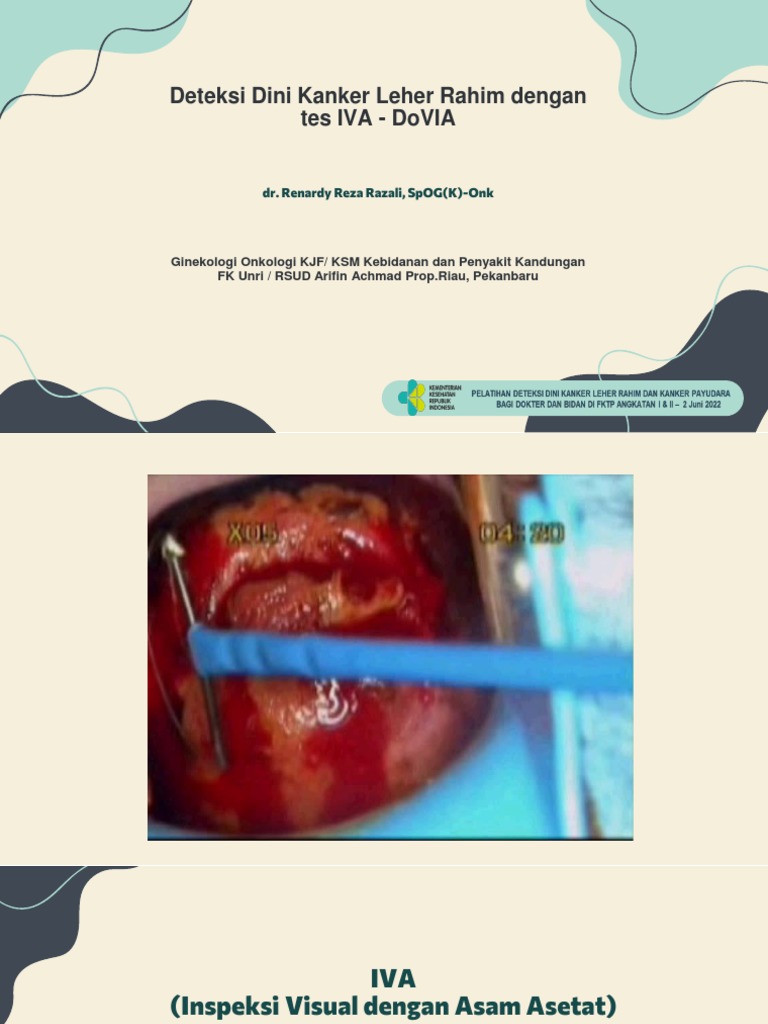 04.06.22 - Deteksi Dini Kanker Leher Rahim Dengan Tes IVA, DoVIA ...
