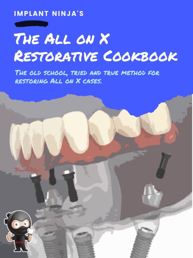The All On X Restorative Cookbook | PDF | Dental Implant | Dentures