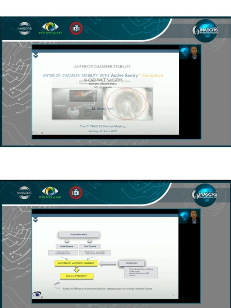 INASCRS 6TH - Anterior Chamber Stability With Active Sentry in Phaco ...