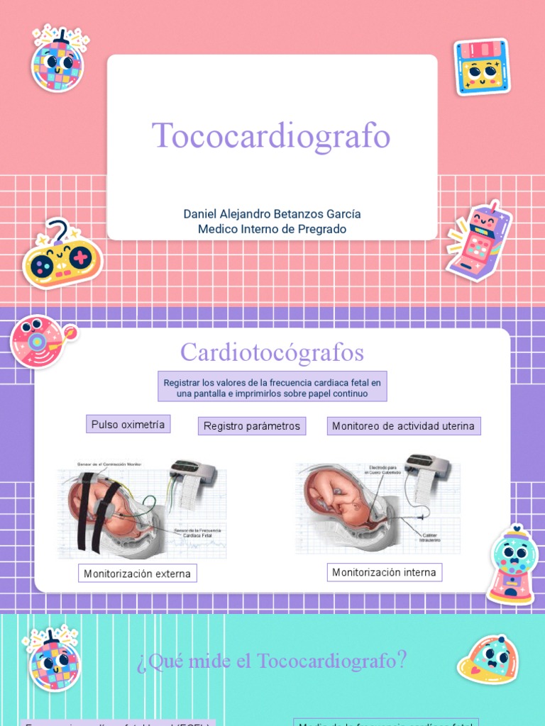 Tococardiografo | PDF