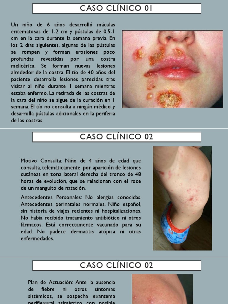 Impetigo | PDF | Enfermedades y trastornos | Causas de la muerte