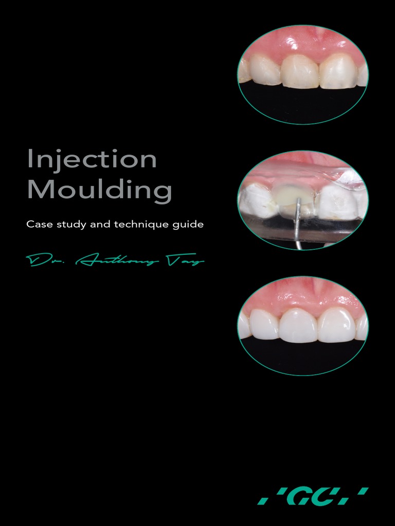 Gcaus Injection Moulding Technique Guide Websecure Pdf
