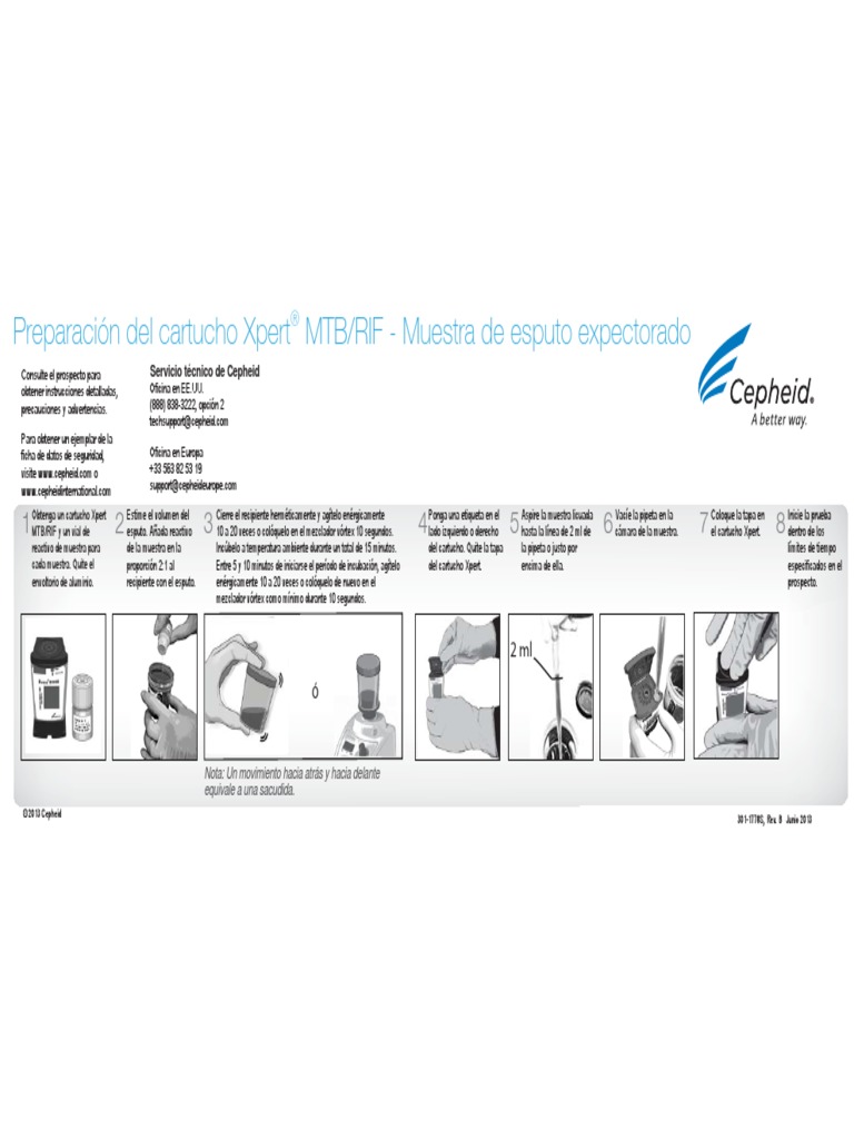 Procedimiento Esputo | PDF
