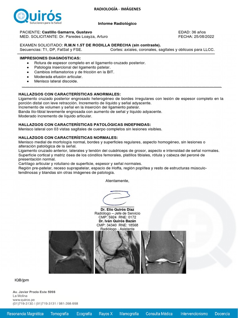 Análisis radiológico de la rodilla derecha revela lesión en el ...
