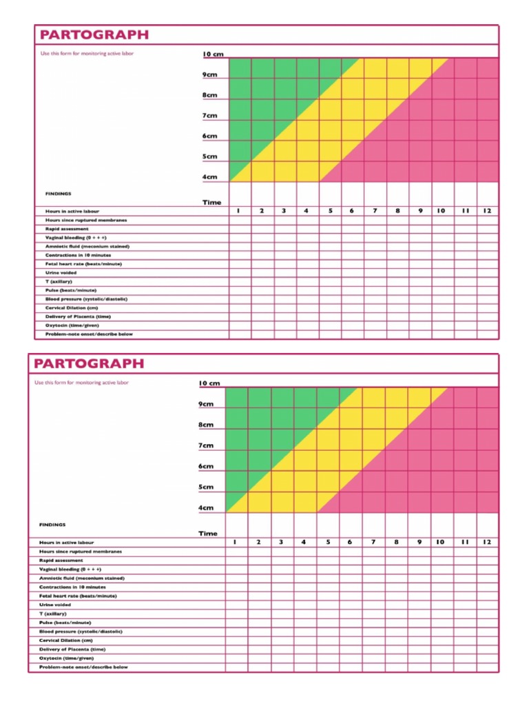 Partograph Form | PDF