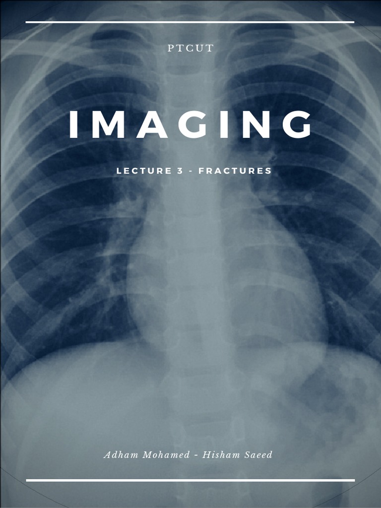 Imaging - Lecture 3 (Fractures) | PDF | Thorax | Vertebra