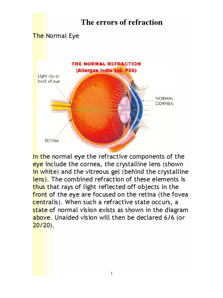 The Errors of Refraction | PDF | Contact Lens | Eye