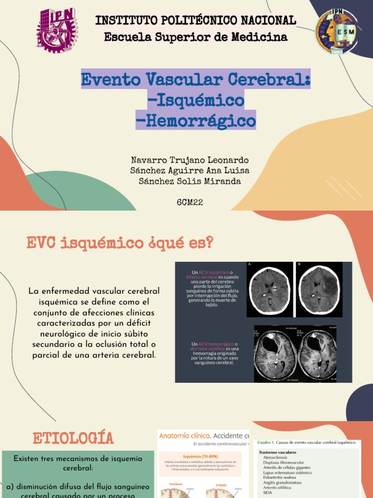 Causas y Tratamiento del EVC Isquémico | PDF