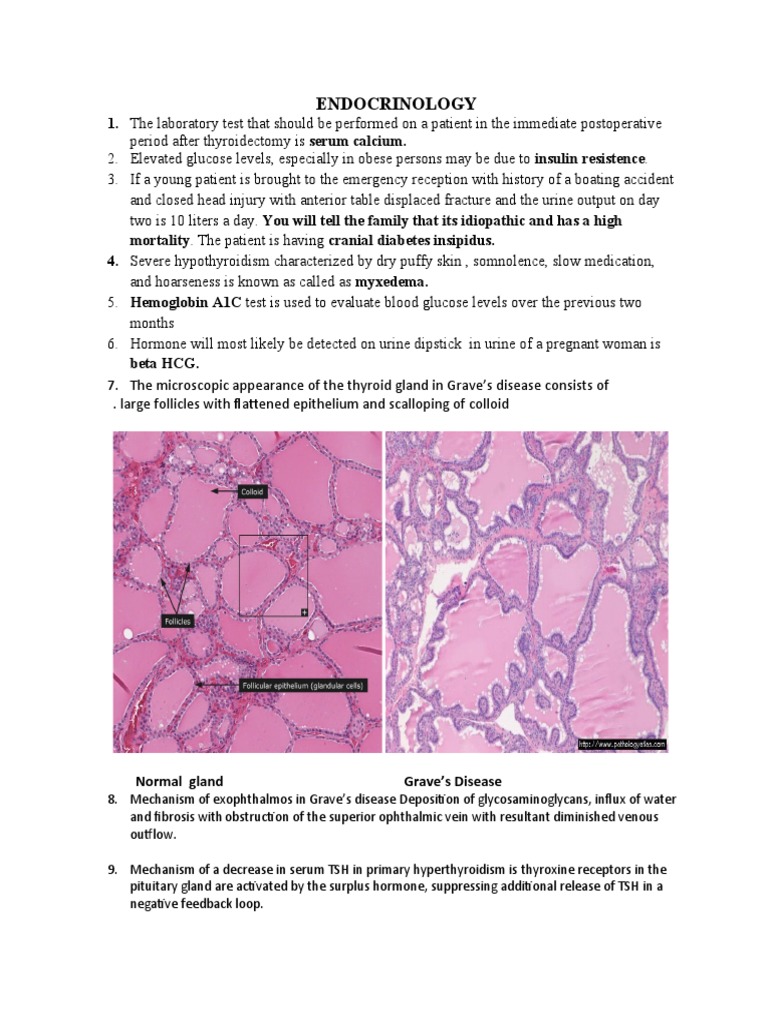 MCQs Endo Final | PDF | Thyroid | Hyperthyroidism