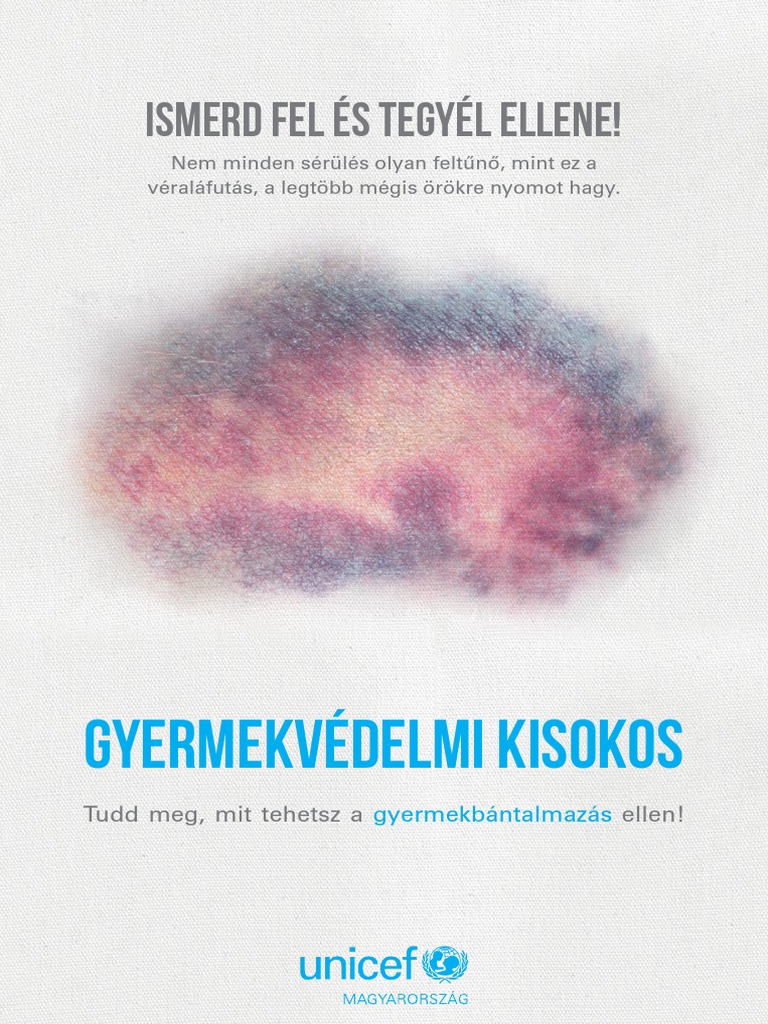 Gyermekvédelmi Kisokos | PDF