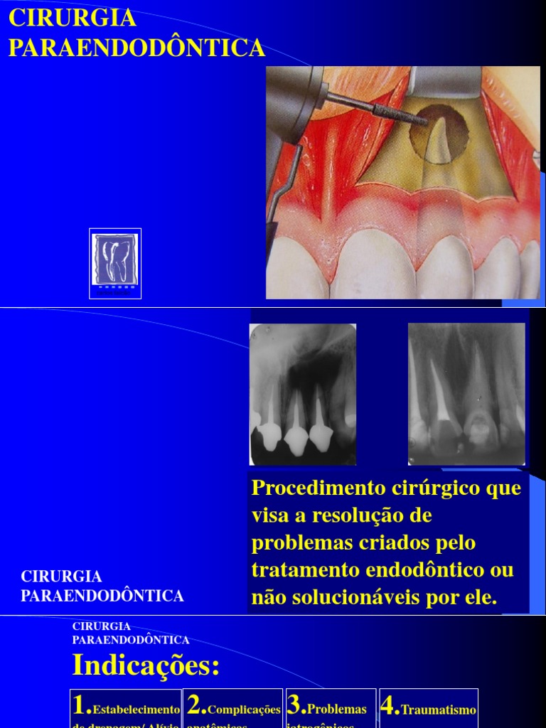 Cirurgia+parendod C3 Bantica | PDF | Sistema de saúde | Remédio