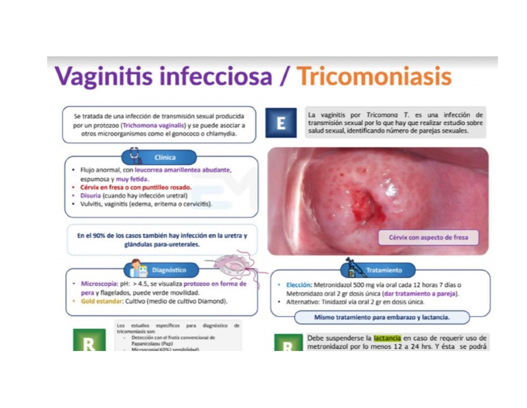 tricomoniasis | PDF
