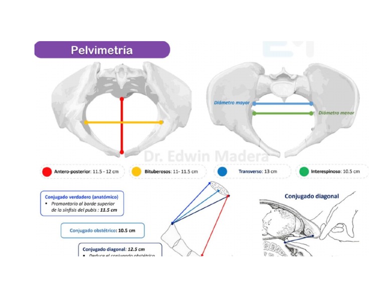 Pelvimetria | PDF